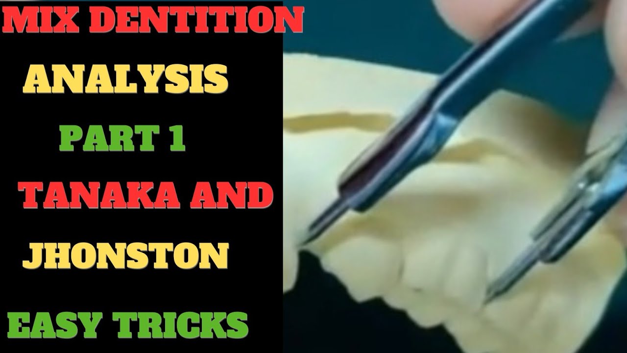 Tanaka And Jhonston Analysis/Mixed Dentition Analysis/Mixed dentition ...
