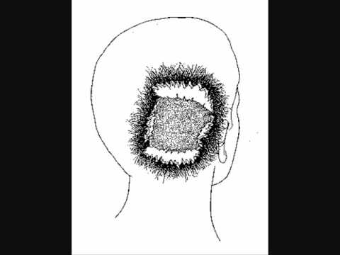 John F. Kennedy Head Wound - YouTube