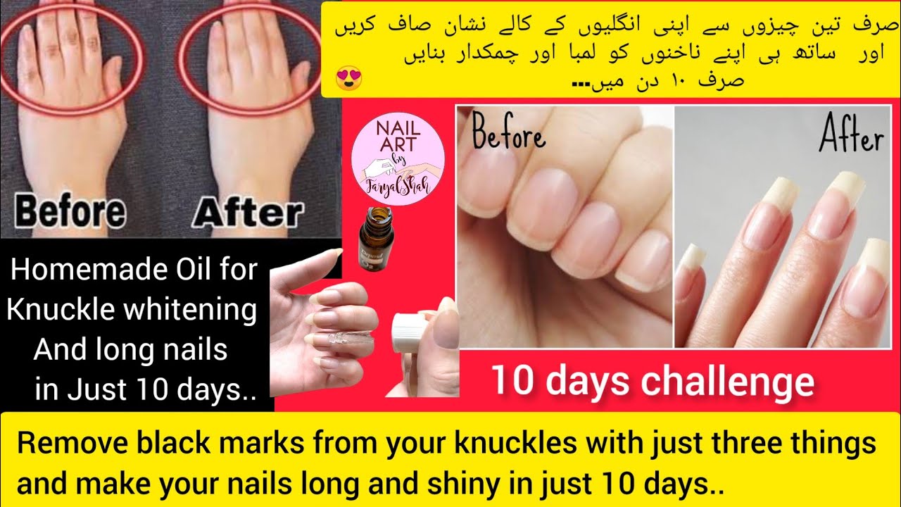 How to grow nails fast in just 10 days | How to get rid of dark ...