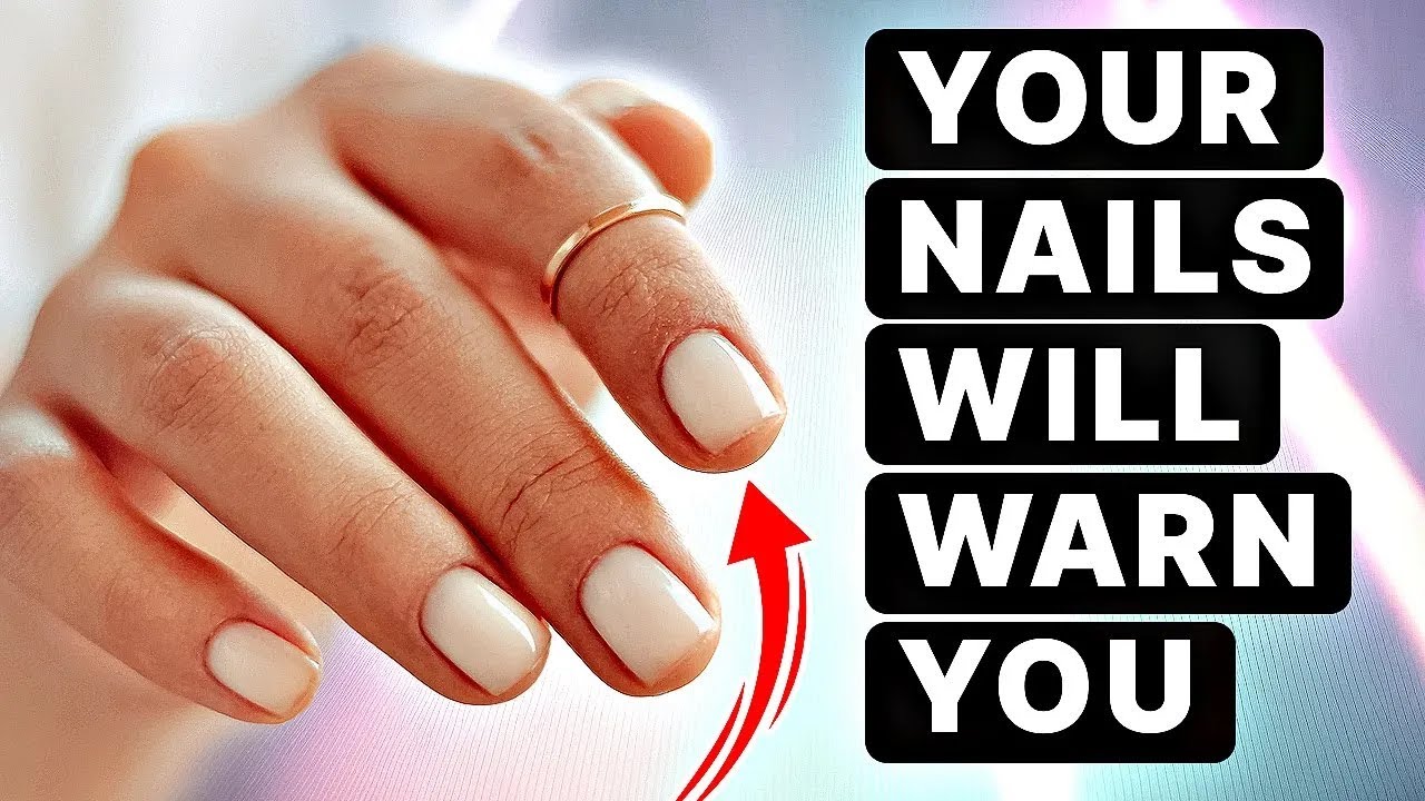 10 WARNING SIGNS Your Nails Will Give You About Your Health! - YouTube