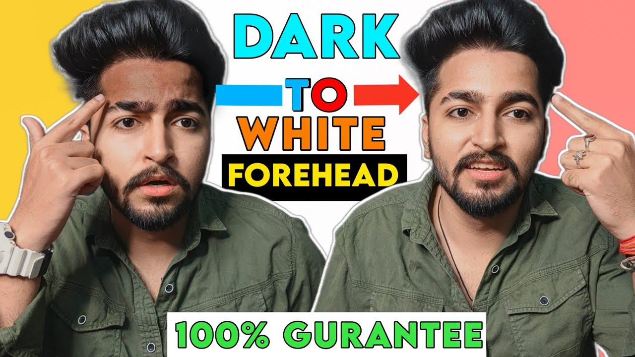 Dark Forehead to White Forehead 100% Gurantee | Sahil Nagpal - YouTube
