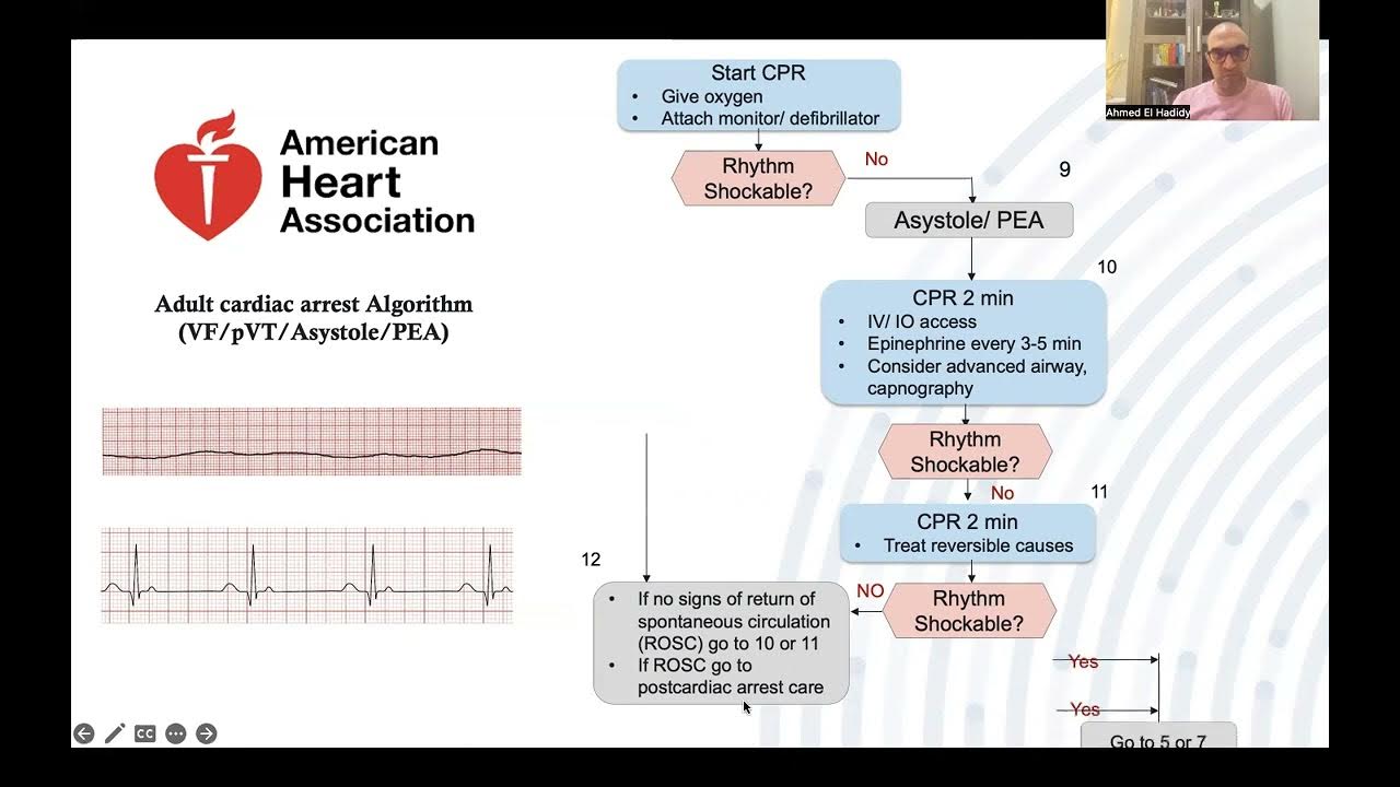 Cardiac arrest ACLS Resuscitation - YouTube