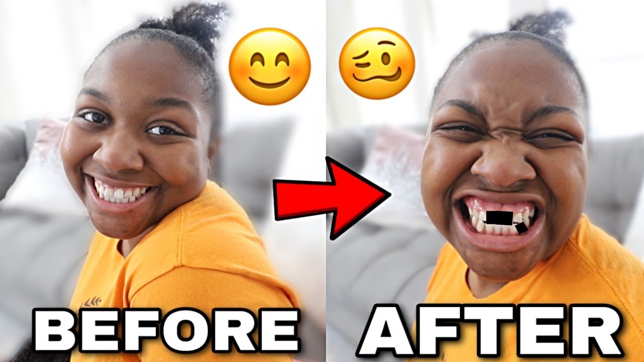 KEN RUINED HER TEETH FOREVER....💔 - YouTube
