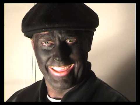 Michael Jackson skin dissorder sufferer Jack Michaelson - YouTube