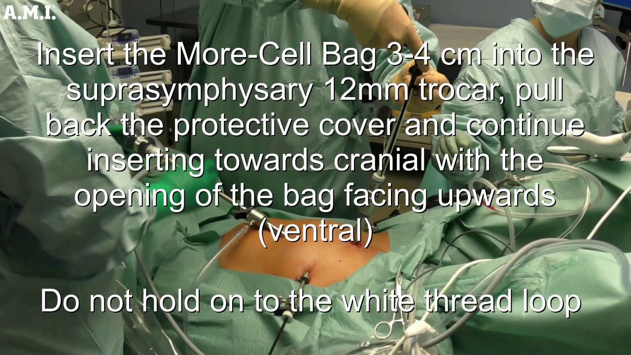 A.M.I. More-Cell-Safe Surgical Instructions - YouTube