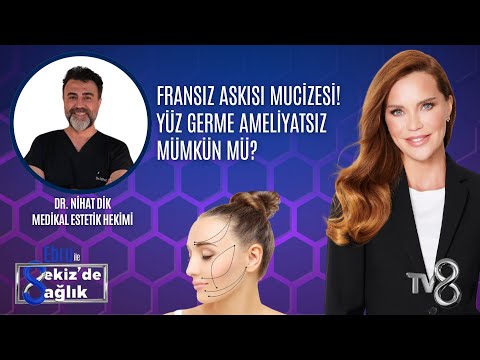 FRANSIZ ASKISI MUCİZESİ! YÜZ GERME AMELİYATSIZ MÜMKÜN MÜ? | DR. NİHAT DİK ANLATIYOR | 8'DE SAĞLIK