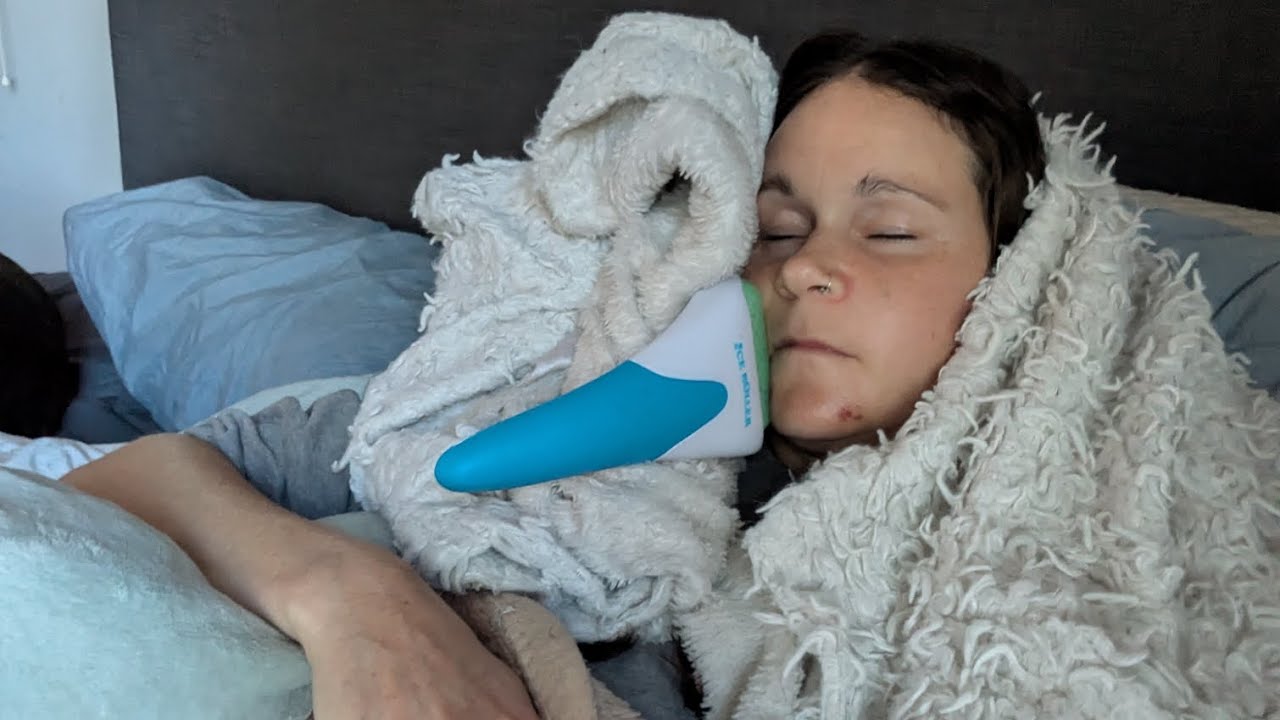 Post-op day 8: Failed Stryker Lefort plate replacement with chin and ...
