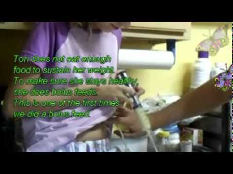 Bolus feed 1st time - YouTube