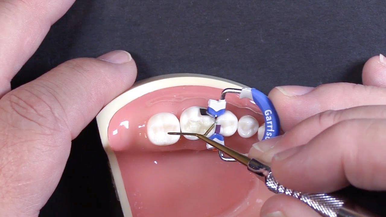 Quick Tip #3 | Rolling the Marginal Ridge - YouTube