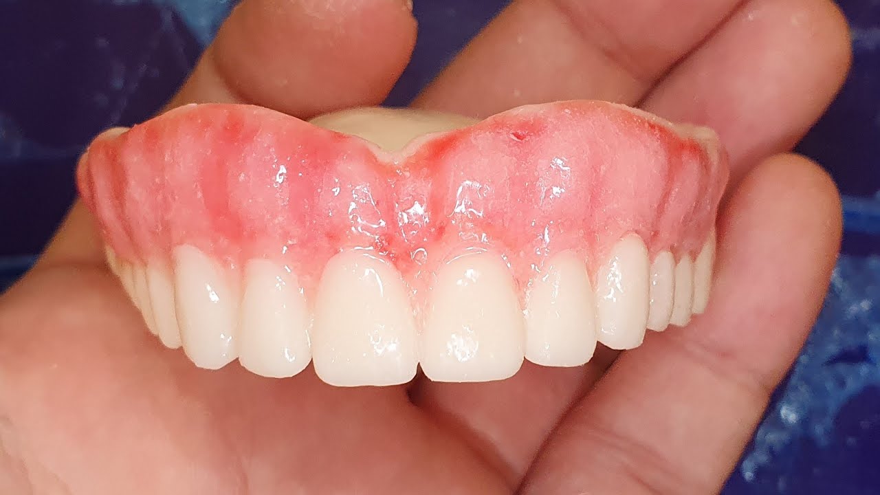 3D Print Digital Denture YouTube 3d-print-digital-denture-youtube