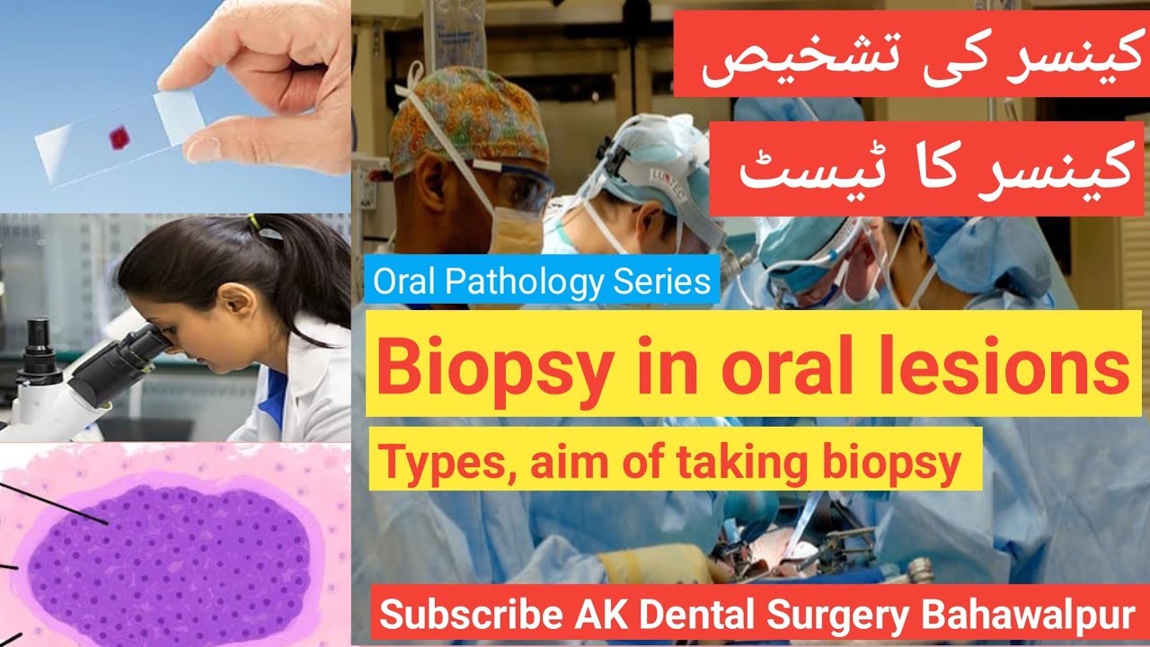 Biopsy test | types of biopsy | biopsy test for cancer | biopsy test ...