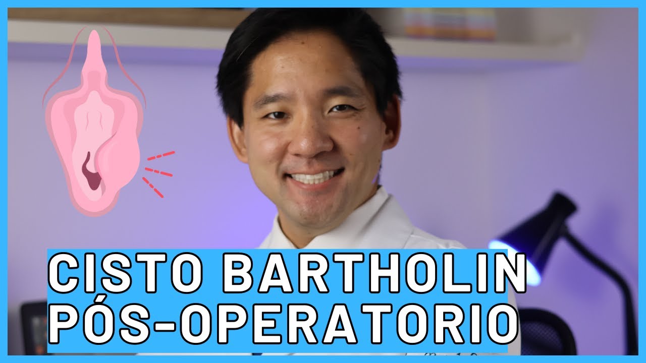 CISTO DE BARTHOLIN: O QUE VOCE PRECISA SABER DEPOIS DA SUA CIRURGIA DE ...