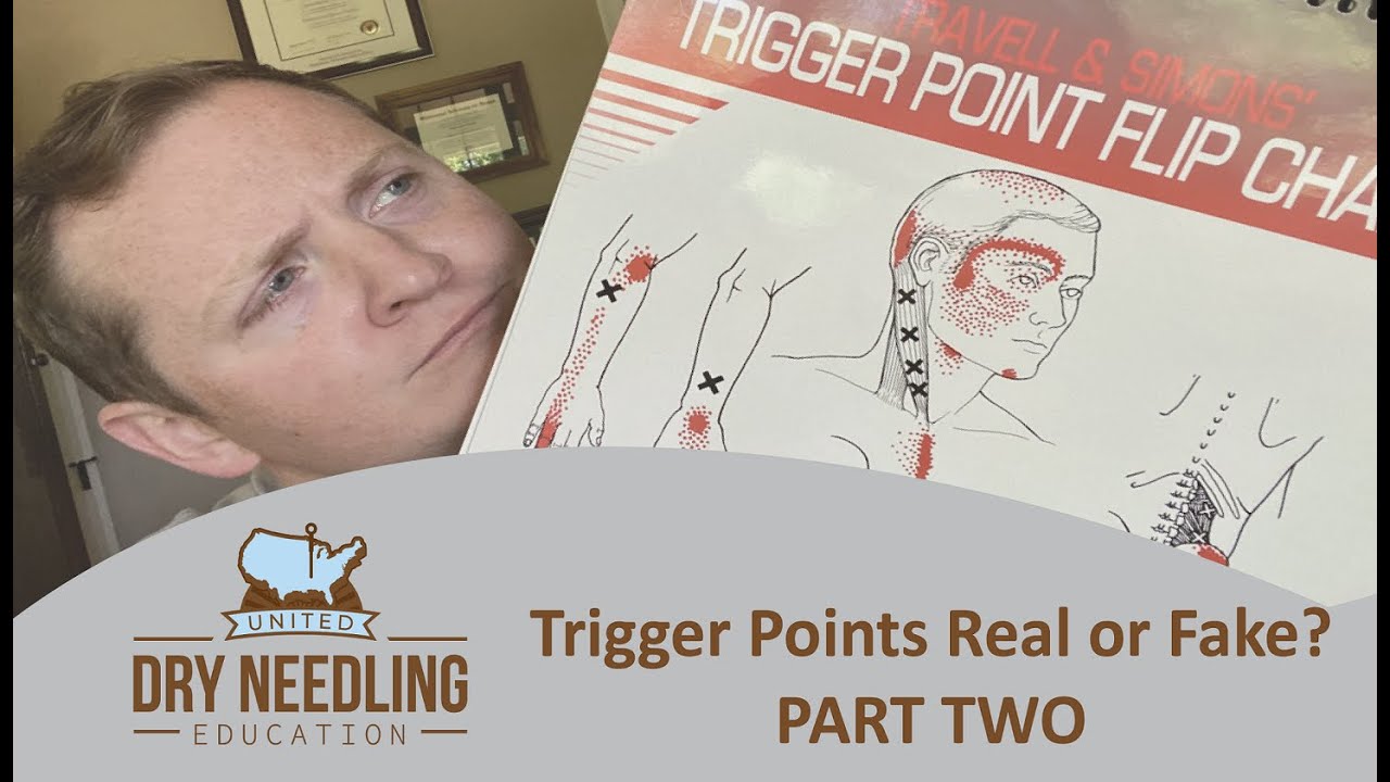 Trigger Points Conclusion: Real or fake? Let's talk about it...Part Two ...