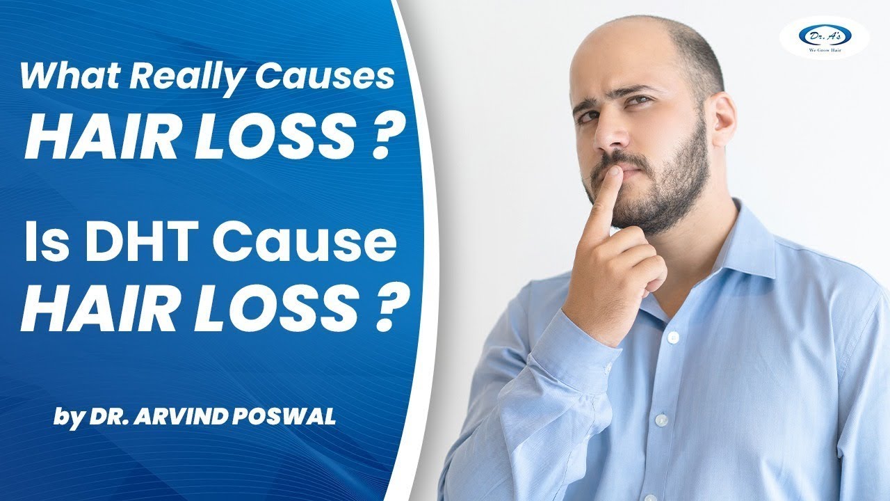 What Really Causes Hair Loss ? Male pattern baldness | Is DHT Cause ...