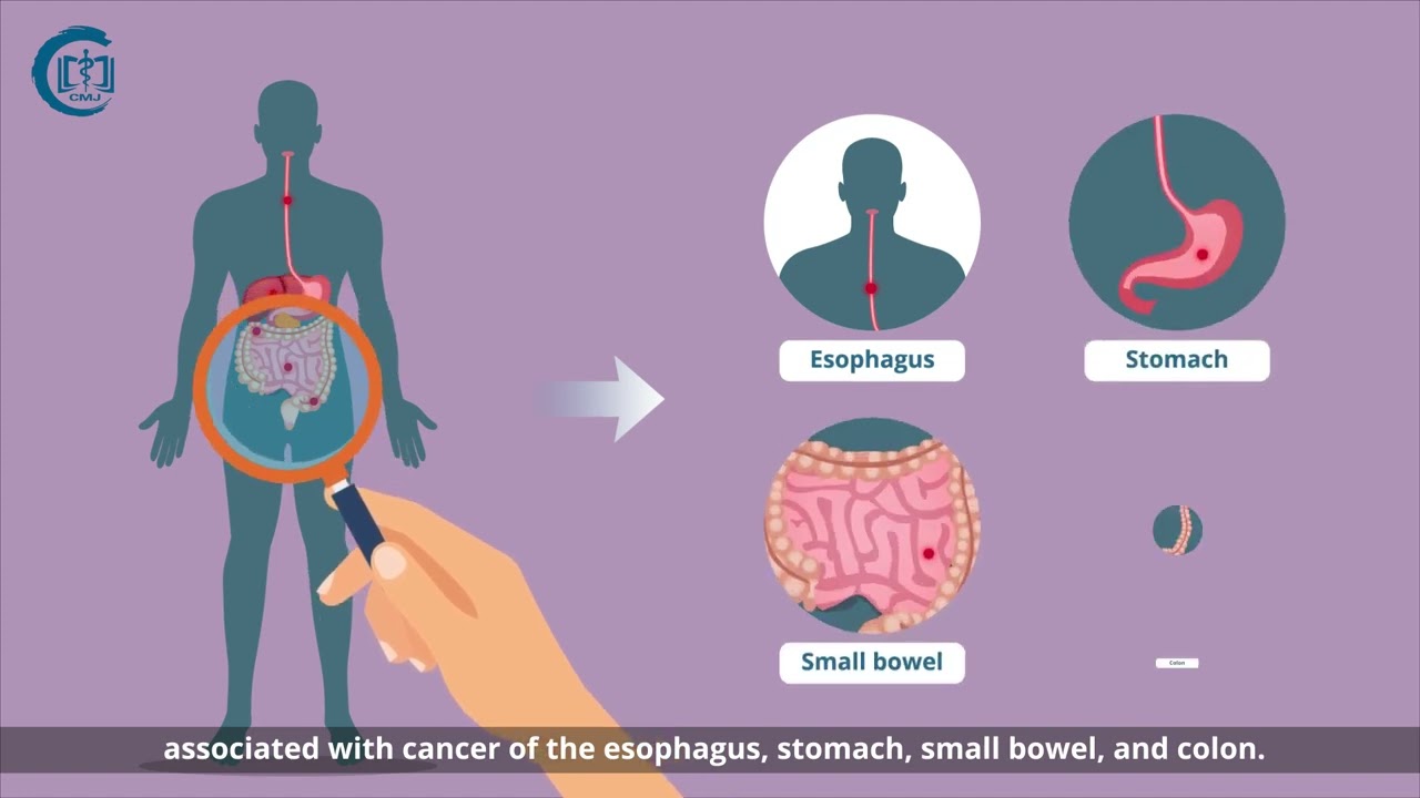 Artificial Intelligence in Gastrointestinal Endoscopy: General Overview ...