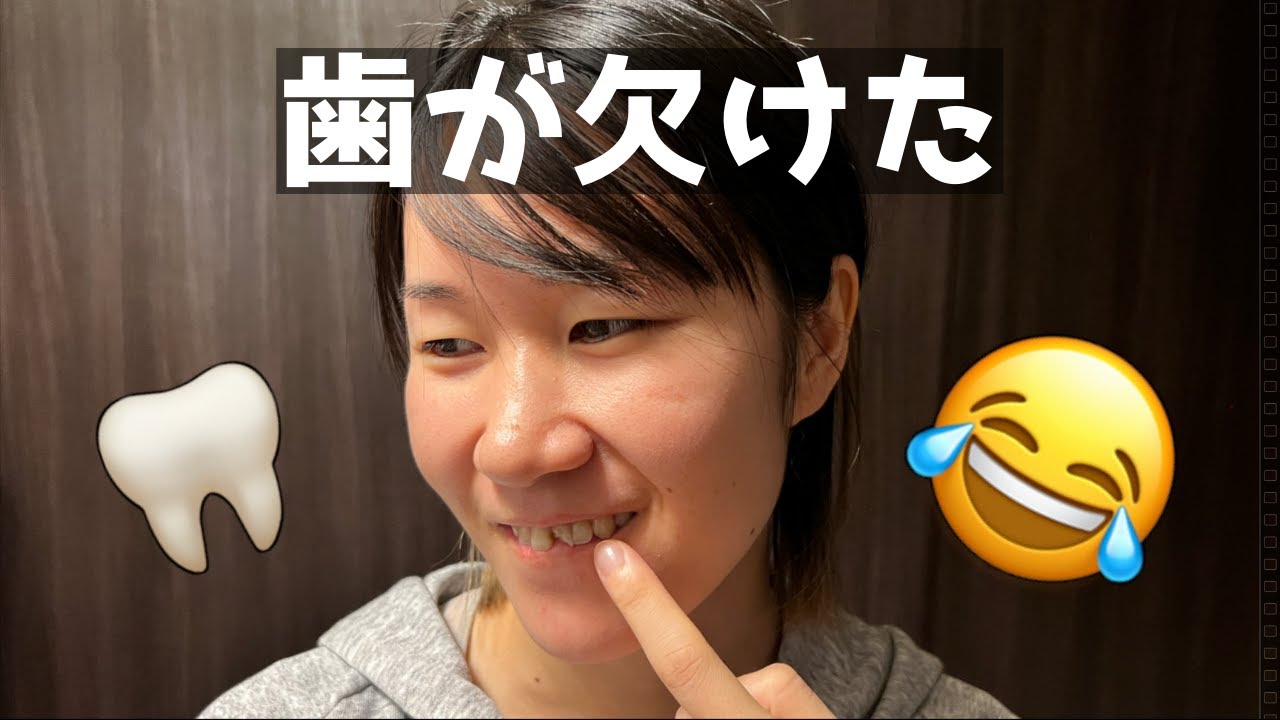 【ご報告】前歯が欠けてしまいました - YouTube