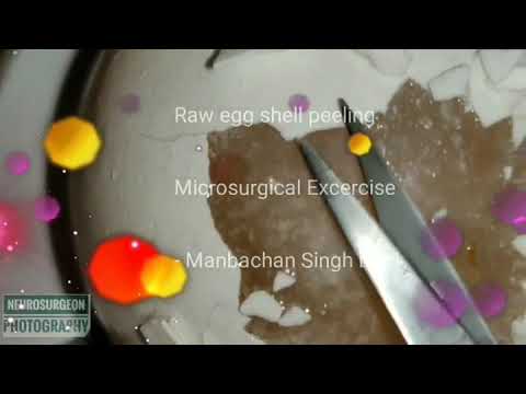 Microsurgical Raw egg shell peeling - YouTube