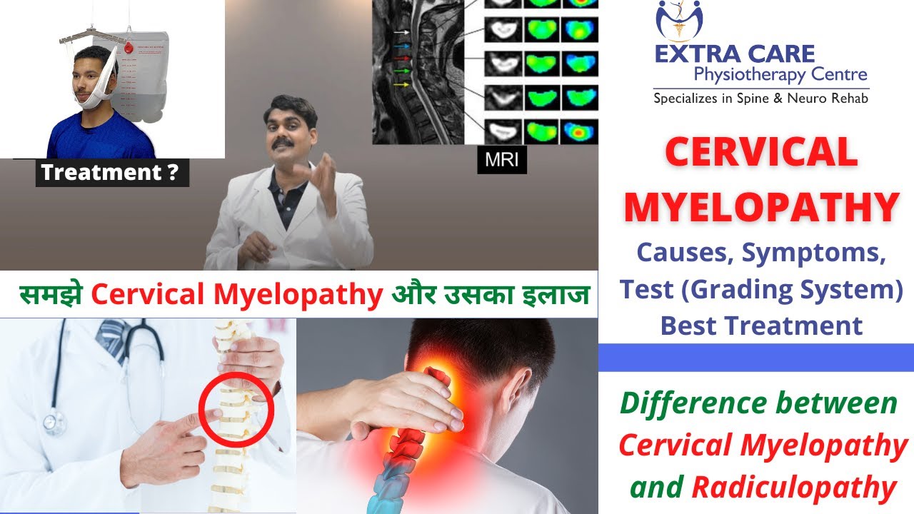Cervical Myelopathy Physiotherapy Treatment Causes Symptoms Test