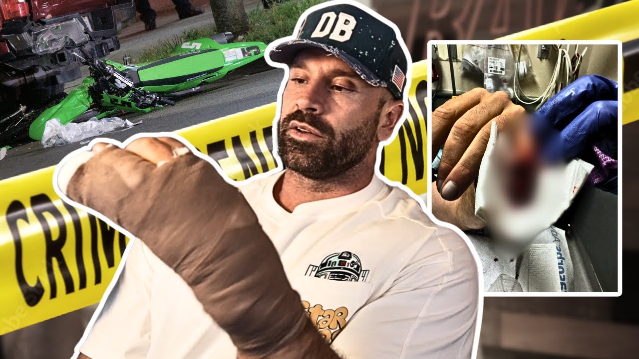 HOW I CUT MY PINKY OFF - YouTube