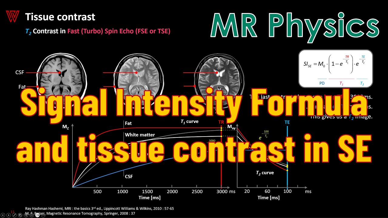 Signal Intensity Formula and tissue contrast in SE - YouTube