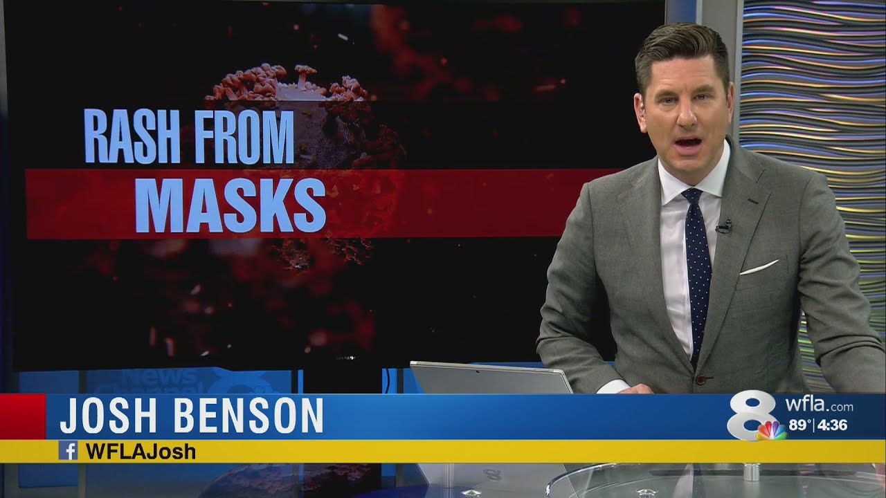 Tampa dermatologist sees cases of 'mask rash' caused by face masks ...