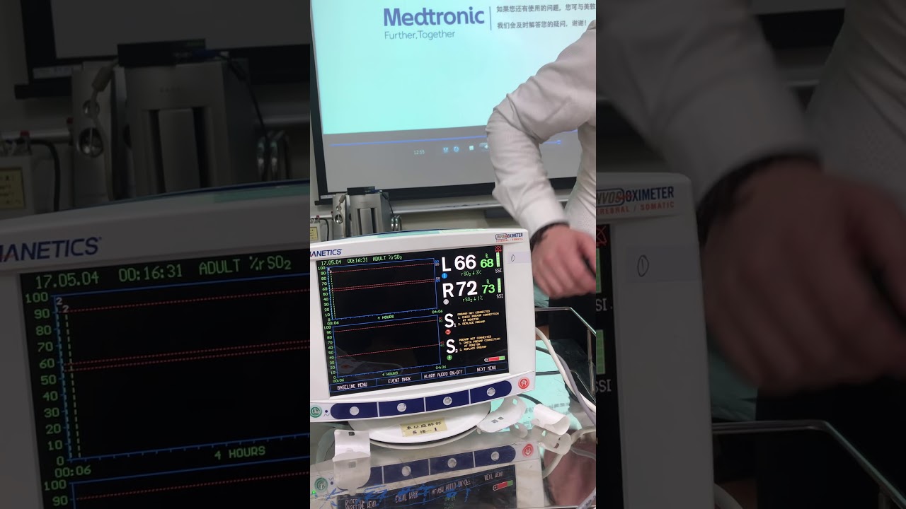 109.01.09 Cerebral Oximeter操作 廠商 2/4 - YouTube