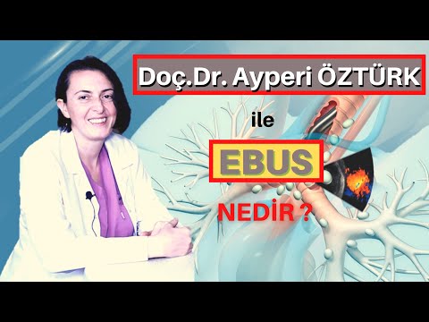 Doç.Dr. AYPERİ ÖZTÜRK İLE EBUS NEDİR?