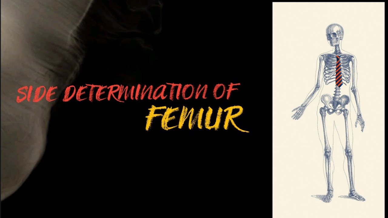 Side determination of femur bone | 3D explained | @mymedicalcorner ...
