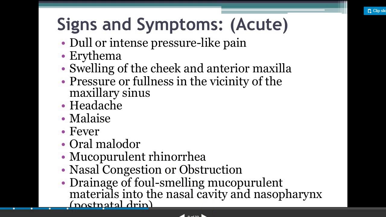 Signs and Symptoms of Acute maxillary sinusitis - YouTube