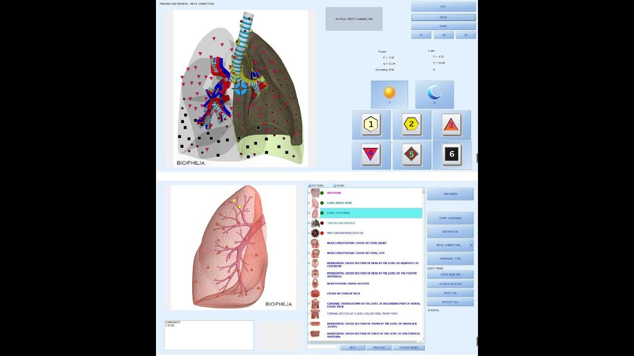 Biofeedback & MetaTerapia (biorezonanta) - YouTube
