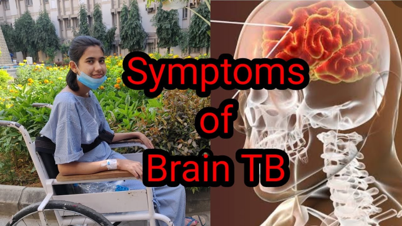 Symptoms of Brain TB. Tuberculosis meningitis ke lakshan.Colours of life - YouTube