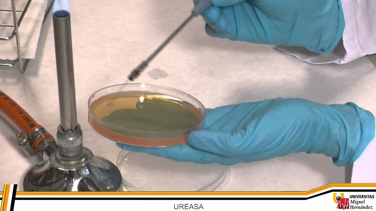 TÉCNICAS UREASA - YouTube