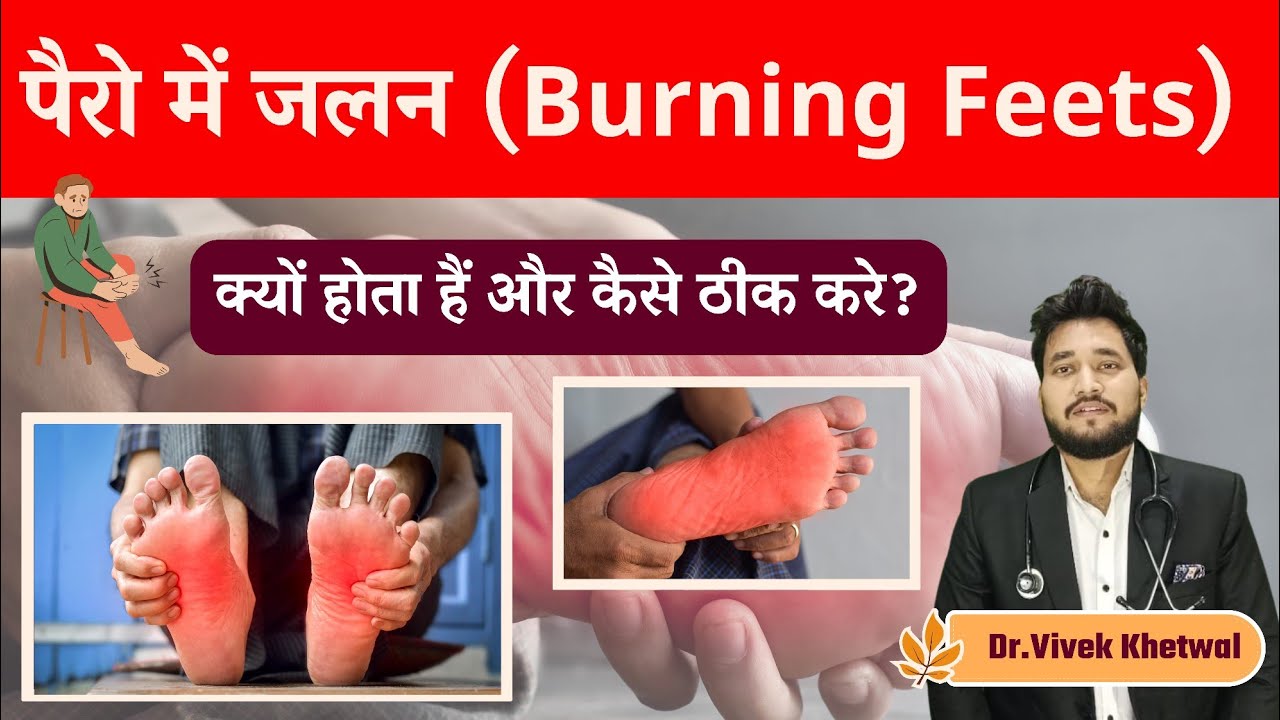 How To Treat Burning Feet ? Dr Vivek Khetwal #burningfeet - YouTube