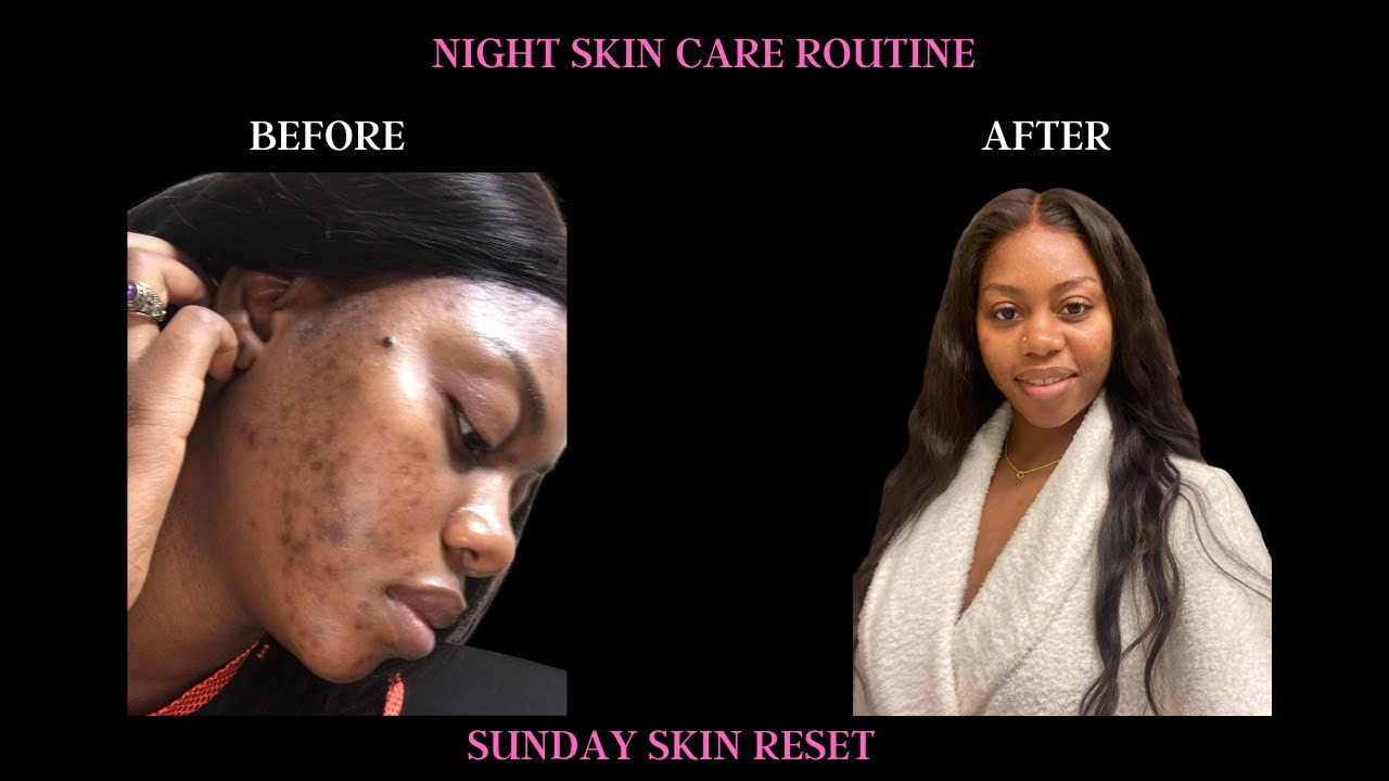 Night Time Skin Routine |PRODUCTS YOU NEED | Easy & Affordable - YouTube