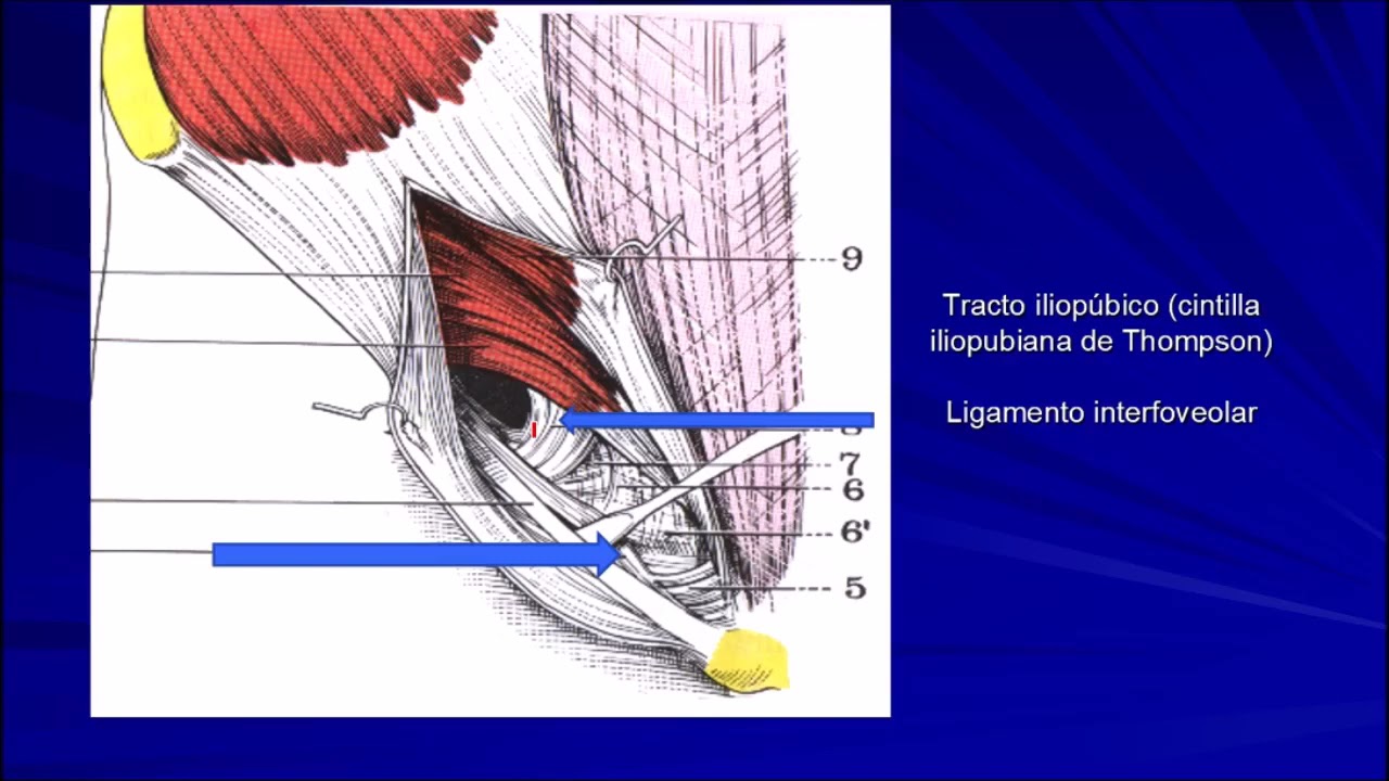 VAINA DE LOS RECTOS Y REGIÓN INGUINAL. PROF. DR. MARCELINO BRÍTEZ ...