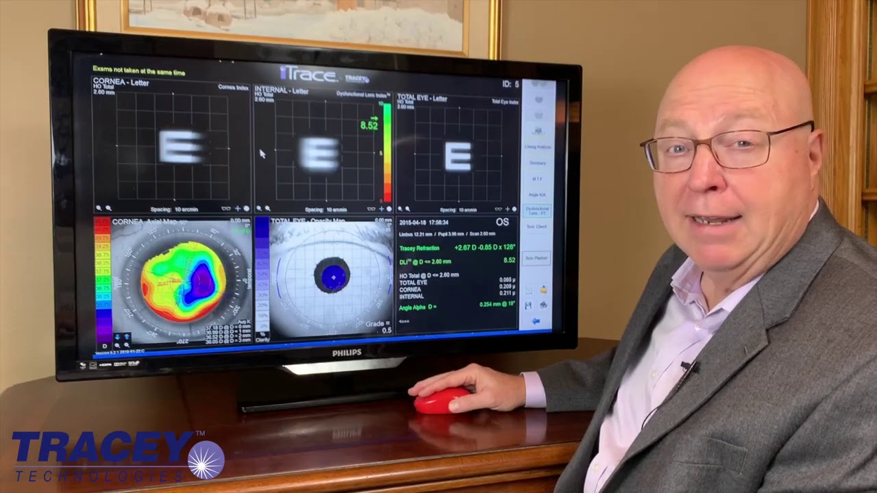 iTrace helps in Post Refractive Patient screening for Lens Compensation ...