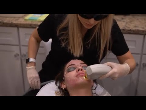 Acne Treatment in Spring Hill, Florida | Skintastic Med Spa