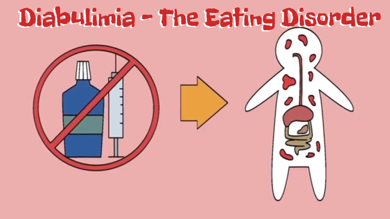 Diabulimia – The Eating Disorder - YouTube
