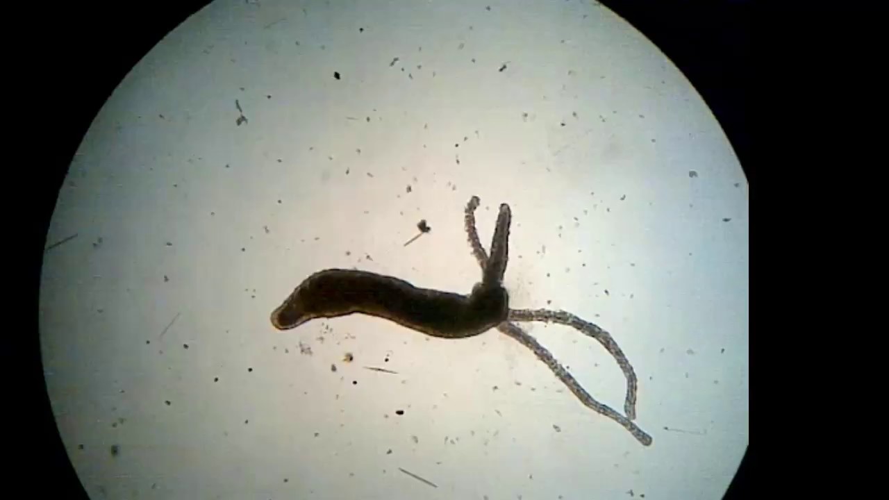 Cnidaria - Hydrozoa - Hydra - YouTube