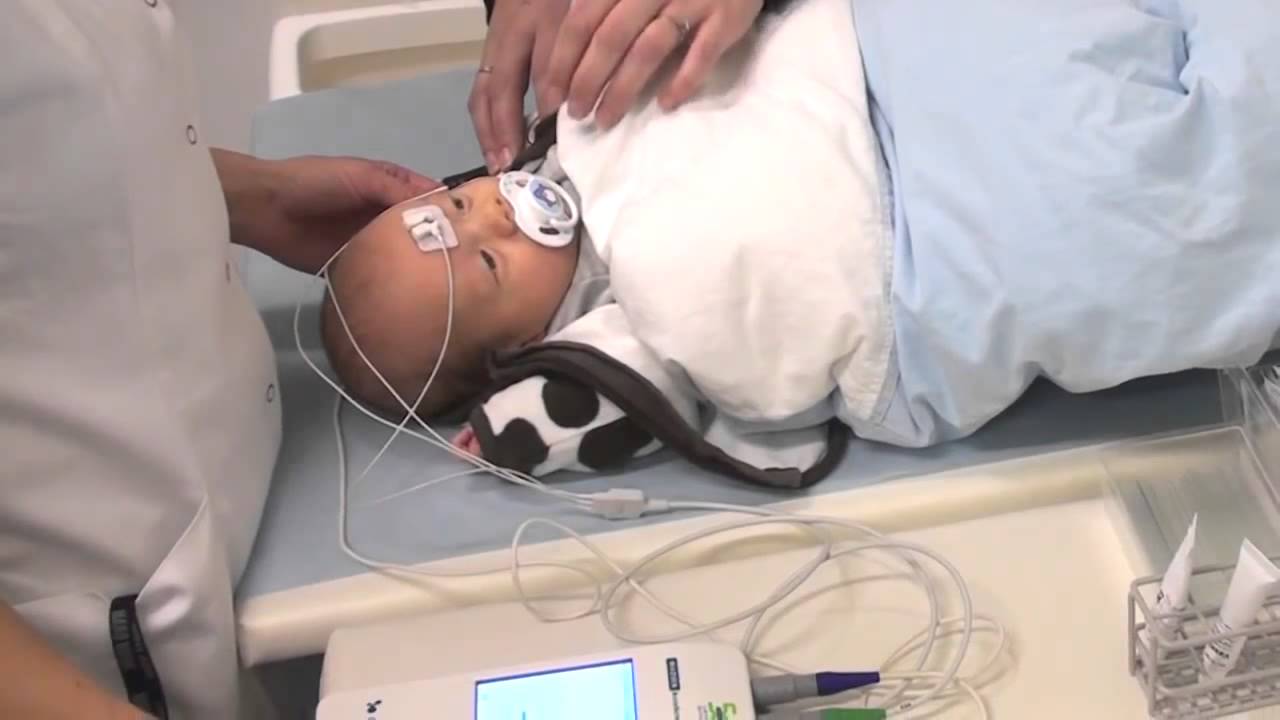 Newborn Infant Hearing Screening MADSEN AccuScreen by Otometrics - YouTube