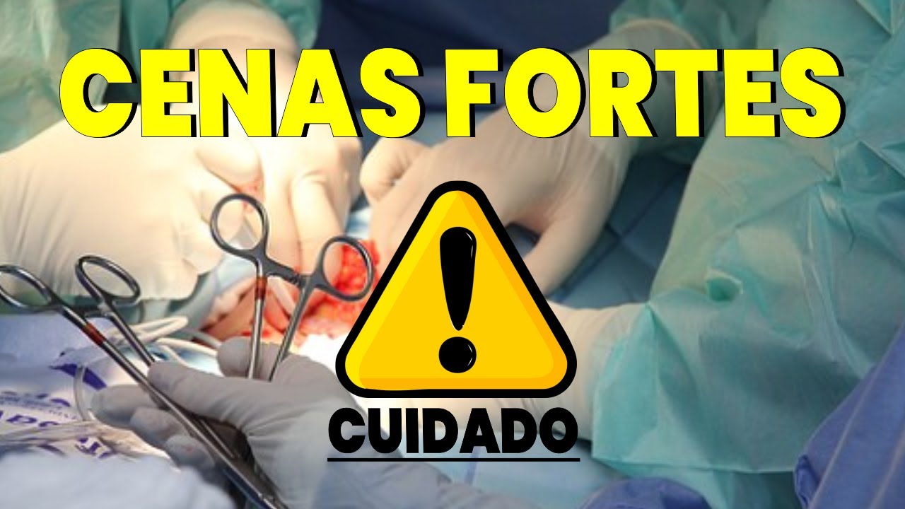 CIRURGIA DE FIMOSE - Veja como é a CIRCUNCISÃO completa POSTECTOMIA ao ...