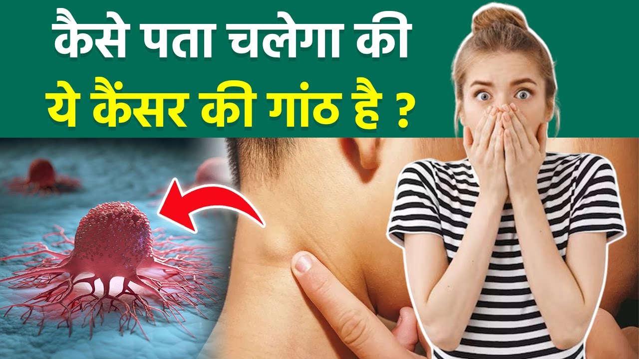 Cancer Ki Ganth kaise Pahchane : कैंसर की गांठ कैसे होती है,पहचान कैसे ...