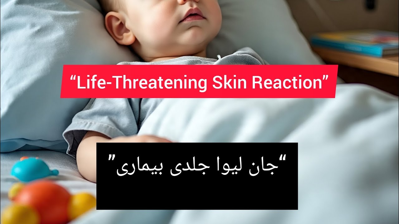 SJS/TEN/Deadly Skin Rash Explained in pushto#doctor - YouTube