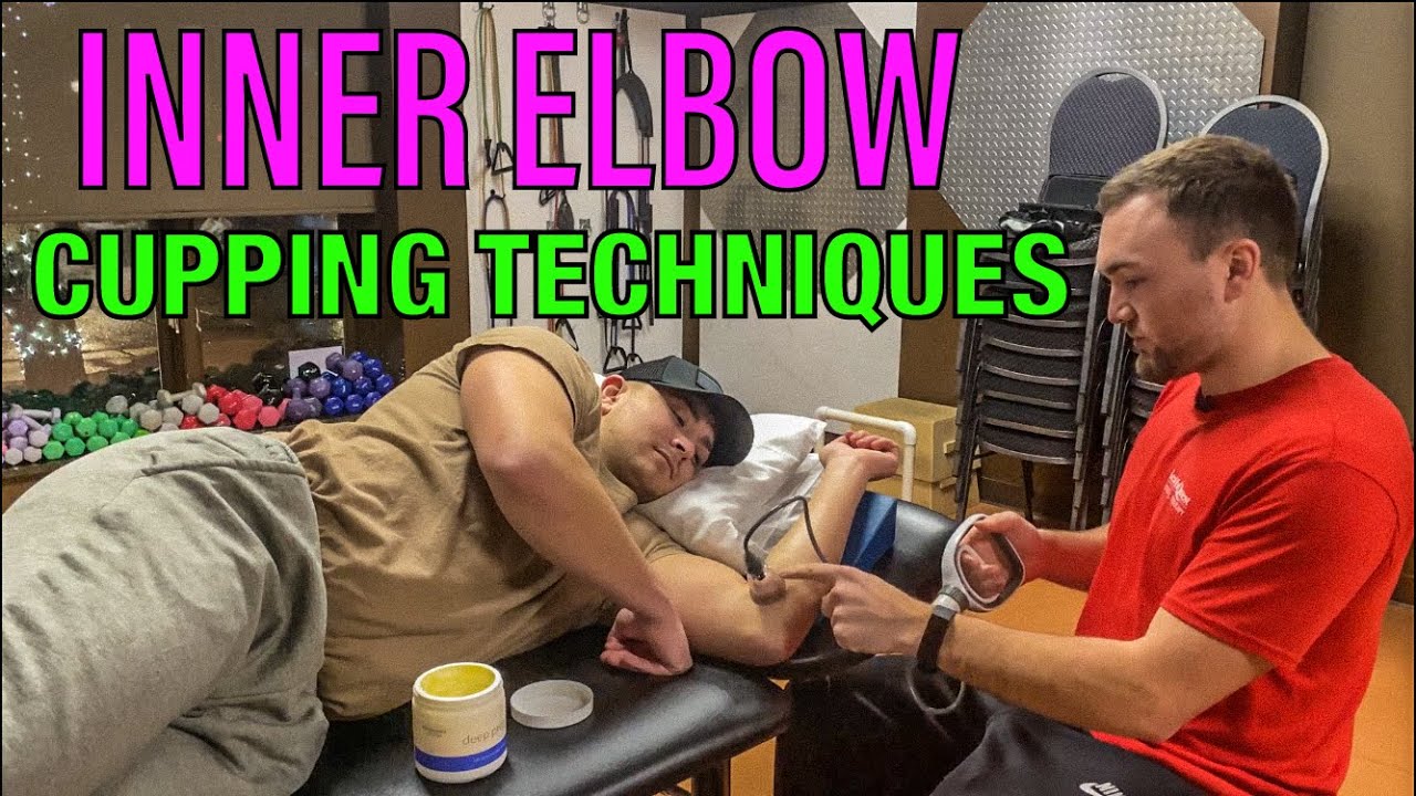 Medial Elbow Cupping Therapy Techniques - YouTube