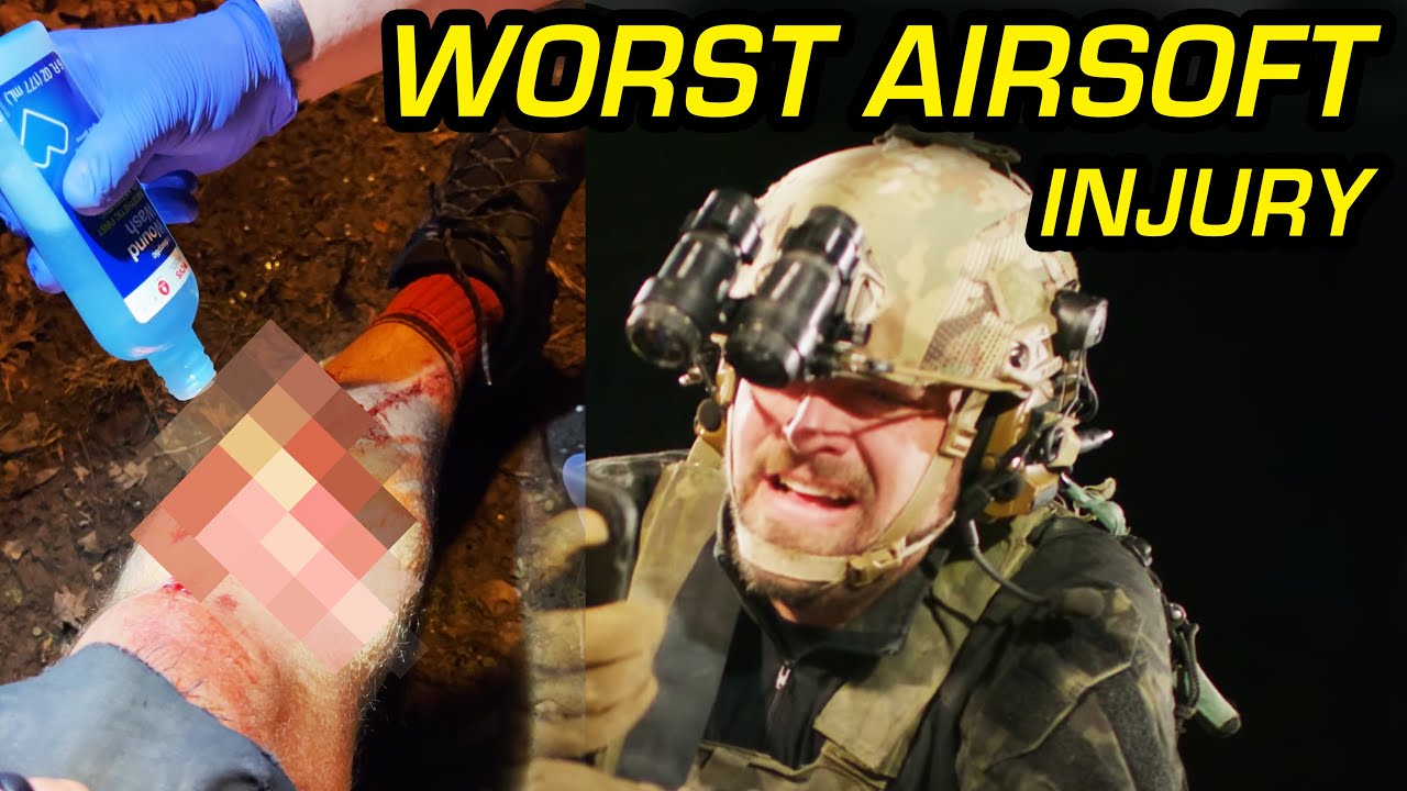 WORST AIRSOFT INJURY - YouTube