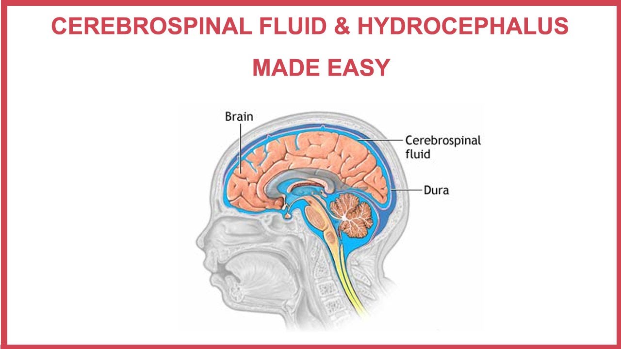 CEREBROSPINAL FLUID & HYDROCEPHALUS MADE EASY - YouTube