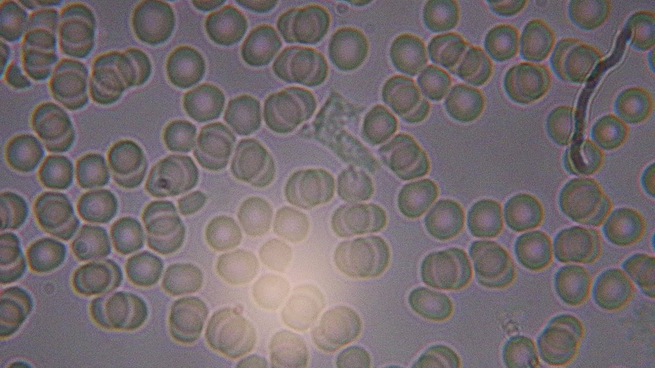 Células sanguíneas sob o microscópio OLYMPUS CHL - YouTube