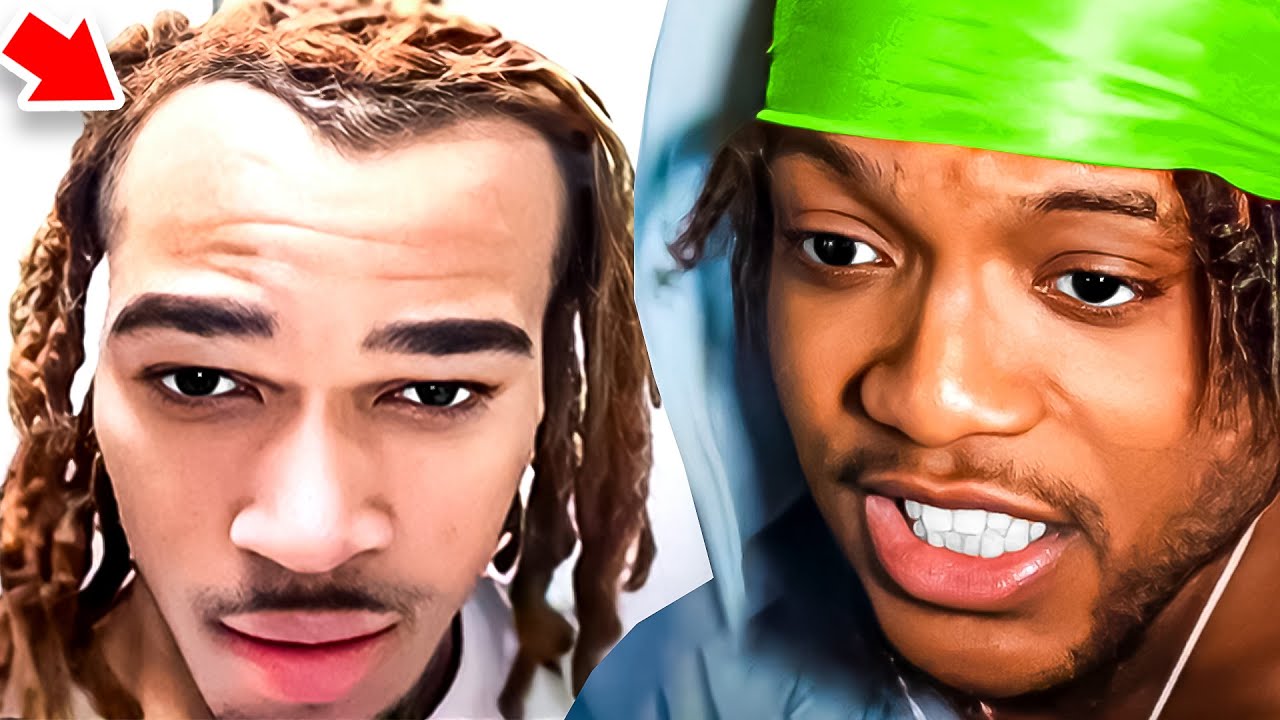 plaqueboymax Hairline MIGHT Be Cooked... - YouTube