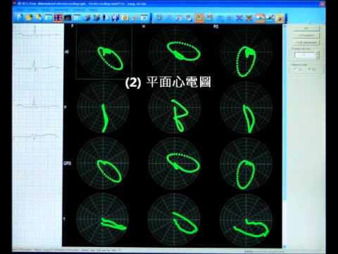 心臟4D立體心電圖, 4D-ECG, 3D-ECG, 心電圖,4D electrocardiogram - YouTube