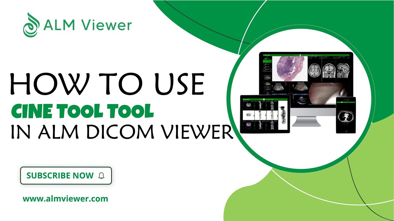 How to Use Cine Tool in ALM Dicom Viewer | By Alm Viewer5 - YouTube